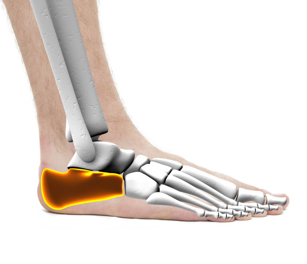 Dolore al tallone: a cosa è dovuto? - Vivere più sani